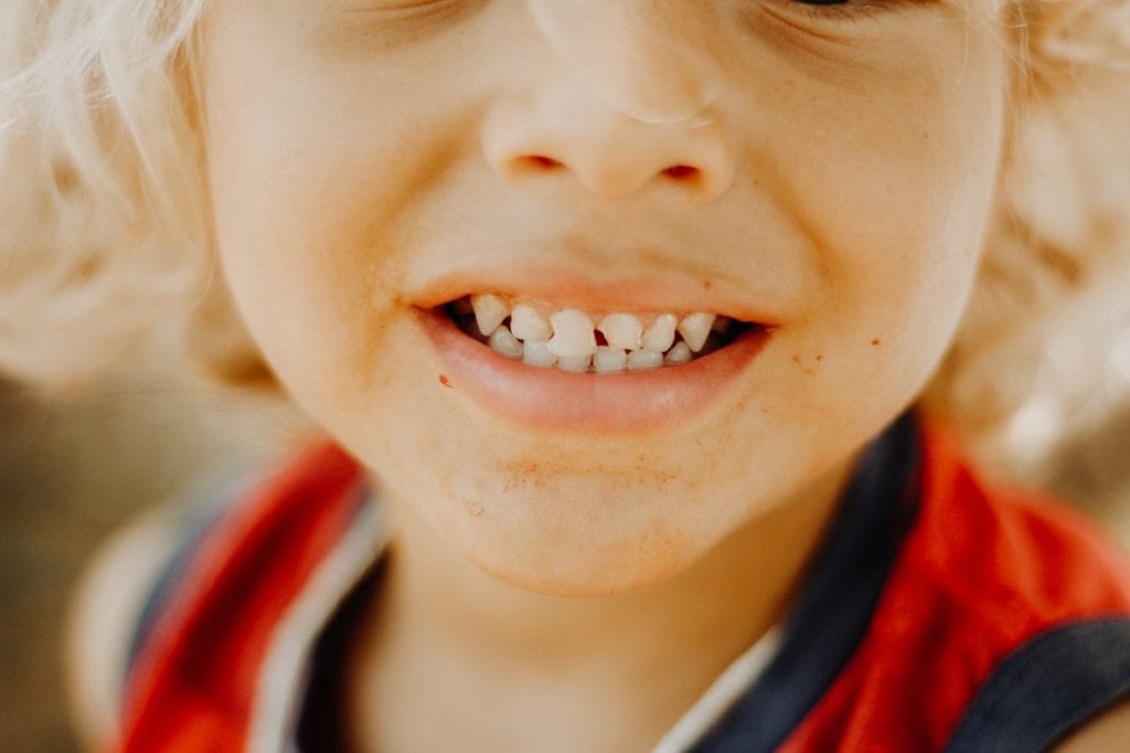 How do I keep my kids teeth healthy?